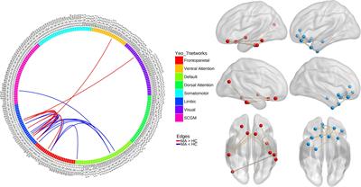 Frontiers | Abnormal resting-state functional connectome in methamphetamine-dependent patients ...